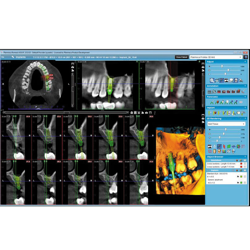 Planmeca ProMax 3D Mid