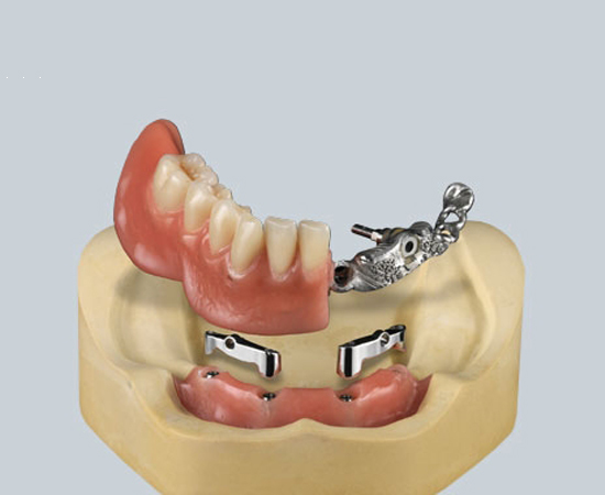 Ceramill® m-bars