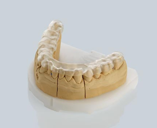 Ceramill® m-splint